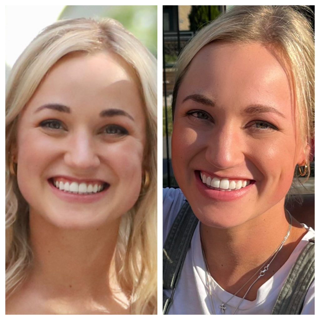 Procedures - Rachel Dahlen, RN Cosmetic Nurse